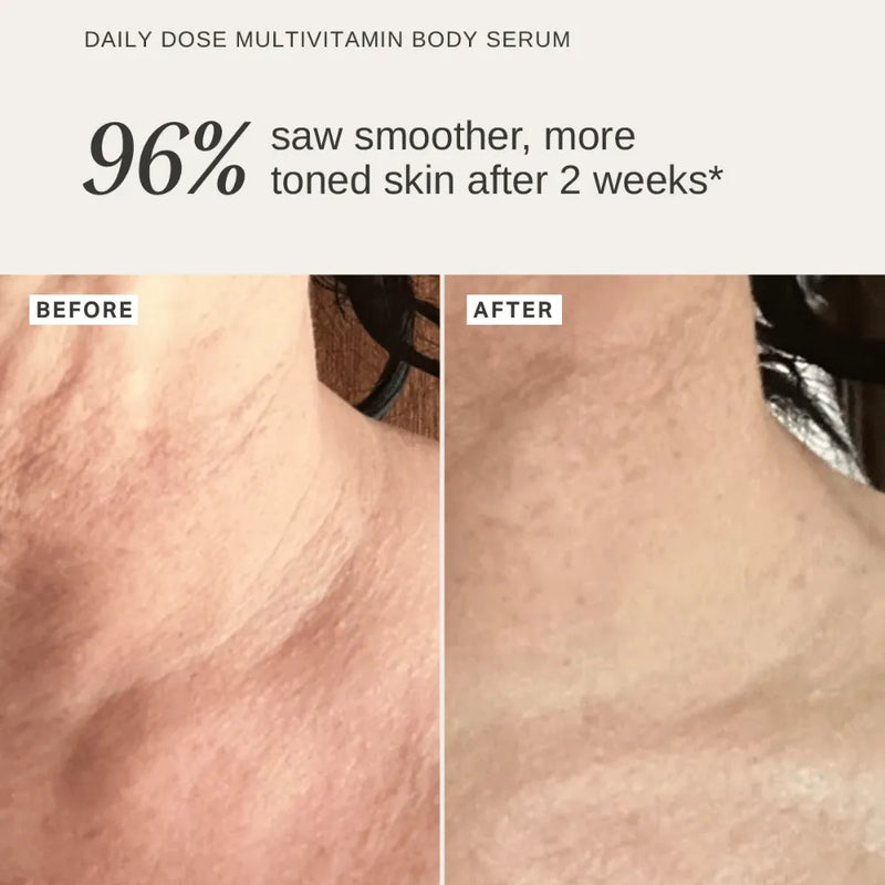 Alpha-H Scalp & Body Trio